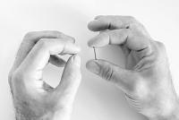 Chevron osteotomy (Austin surgery)